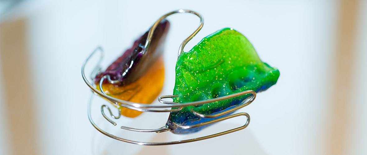 herausnehmbare Spangen - Praxis für Kieferorthopädie Berlin Karlshorst